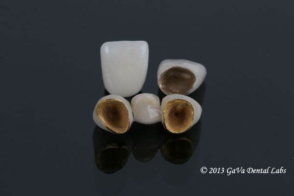 Captek gold resotrations